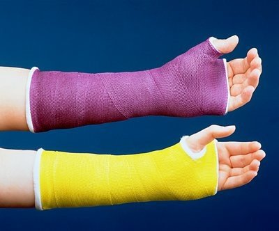 CE &amp; FDA Approved Medical Dressing Bandage Orthopedic Fiberglass Casting Tape