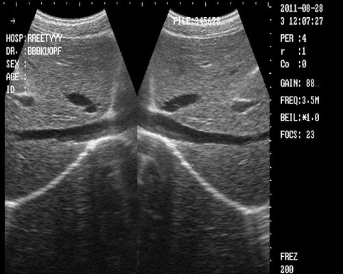 CE&ISO ultrasound scanner/Factory ultrasonic machine/Echo device/Sonography medical equipment/18-month usg scanner