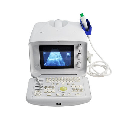 Human Portable Ultrasound Scanner with 18-month warranty/CE Ultrasonic with factory support/USG echo device/Sonography