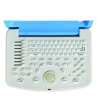CE&ISO ultrasound scanner/Factory ultrasonic machine/Echo device/Sonography medical equipment/18-month usg scanner