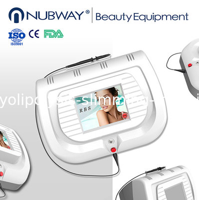 High Frequency Spider Vein Removal Machine / Leg Blood Vessel Treatment