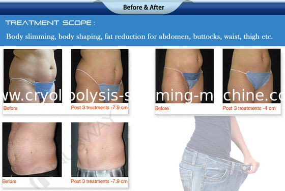 Newest design good result clinic used HIFU body Slimming machine