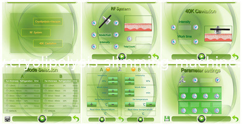 CE approval factory price Cryolipolysis slimming machine with five handles