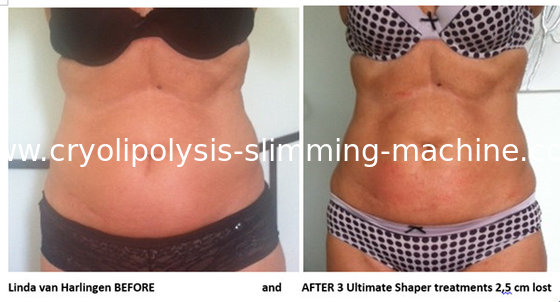 Newest model effective salon used HIFU body Slimming machine