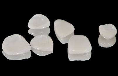 Comfortable Dental Composite Veneers , Teeth Cosmetic Dentistry Veneers