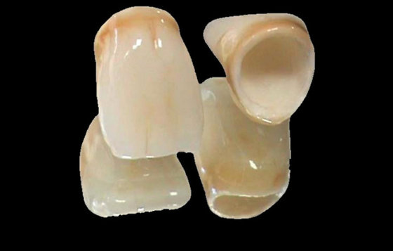 ISO13485 BIO HPP Crowns Light Weight New Technology Perfect Restoration