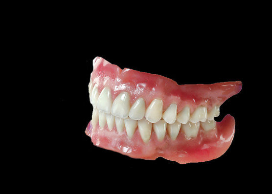 Safety BioHpp Crown Good for the Gingiva after restoration