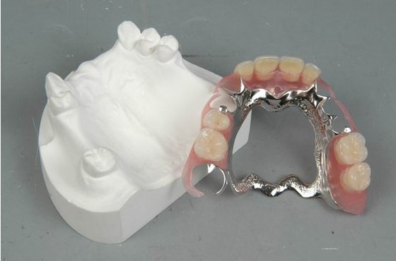 Strong Metal Partial Dentures Framework Virtually Invisible Good Biocompatibility