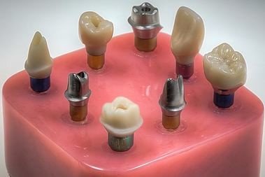 CAD / CAM Custom Titanium Implant Abutment , Straight Temporary Abutments
