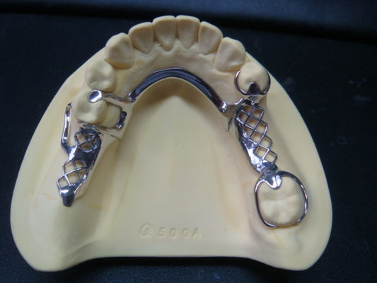 Custom Popular Small Cast Partial Dental Framework Strong Abrasive Resistance