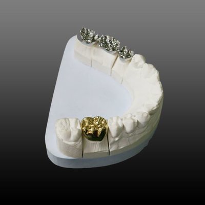 Durable Crown Full Cast High Noble Metal Noble Gold Alloy Crown