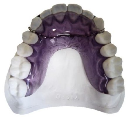 Straightening Teeth Functional Orthodontic Appliances Geheel Open Activator FDA Approved