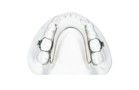 Spring Splint Material Dental Orthodontic Appliances For Tongue Thrust Lightweight
