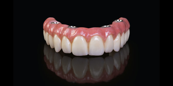 Titanium Hader Bar Attachments Metal Based Dentures For Comestic Defects Implants