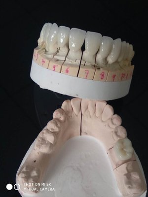 Hospital , Clinic Dental Crown Lab Doing Cases With 3D Digital Work