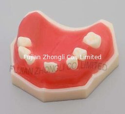 China sinus lift dental implant from China supplier