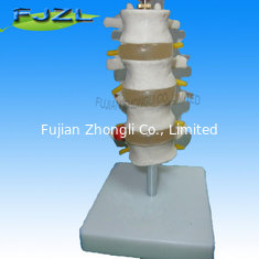 China Plastic Human 4parts Lumbar Vertebrae Set Model With Life Size supplier