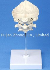 China Atlas, Axis and Occipital Bone supplier
