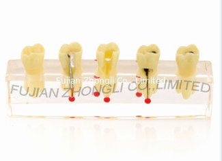 China dental endodontic treatment model supplier