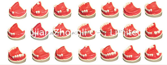 dental model for partial denture restorative supplier