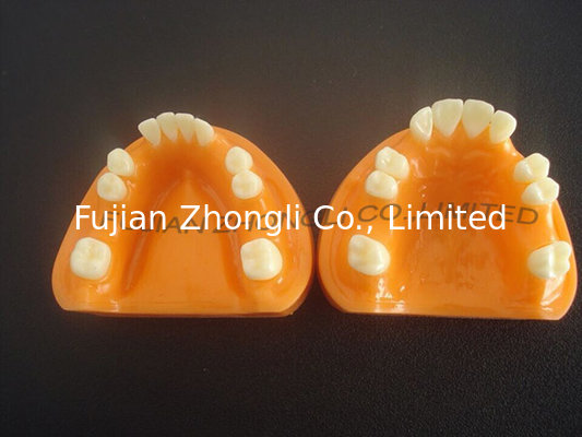 dental model for partial denture restorative supplier