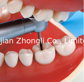 High Quality Typodont Teeth Model with Removable Screw Teeth supplier