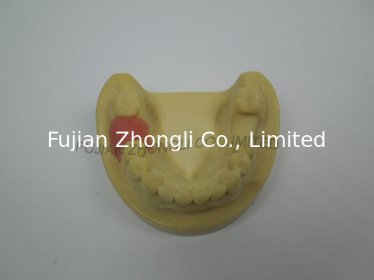 dental implant material bone graft implant for suturing supplier