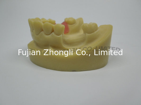 dental implant material bone graft implant for suturing supplier