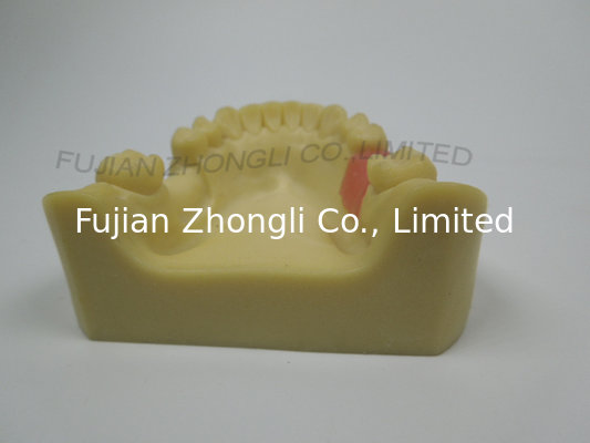 dental implant material bone graft implant for suturing supplier