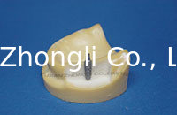 DT1447172 Bone Graft Practice Model supplier