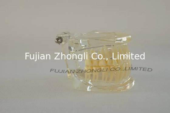 Dental half Multiple Pathologies Disease Implant Model and half Healthy Model supplier