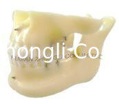 Dental Oral dentistry practice model teaching training material imitation bone simulation oral model supplier