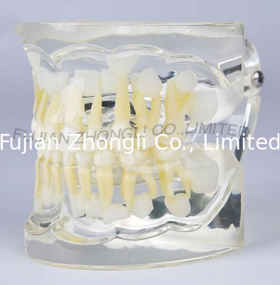 Dental Transparent Standard Model of 3 - year - old Alternative Model supplier