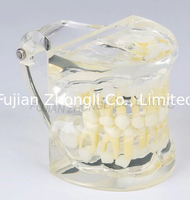 Dental Transparent Standard Model of 3 - year - old Alternative Model supplier