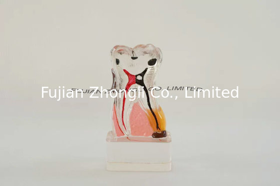 dental transparent 4 times periodontal disease model supplier