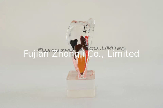 dental transparent 4 times periodontal disease model supplier