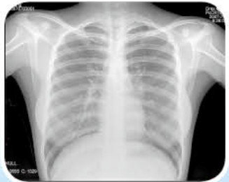 Impresoras térmicas de Agfa que imprimen productos médicos de la película del laser X Ray de la imagen de Digitaces