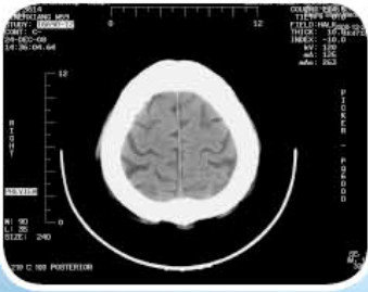 Película seca médica para el sitio del color y el endoscopio ultrasónicos del intestino del estómago