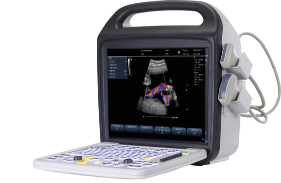 15" ultrasonido portátil de Doppler del color de la pantalla del LCD con funcionamiento estable de la imagen
