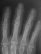 Película sensible verde de X Ray para los huesos y el examen suave los 25x30cm del tejido