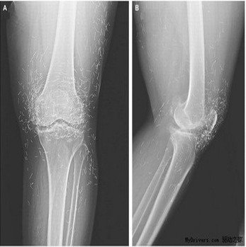 Película seca médica de la exploración de la película de la proyección de imagen, película de radiografía del laser Agfa Fuji del CT