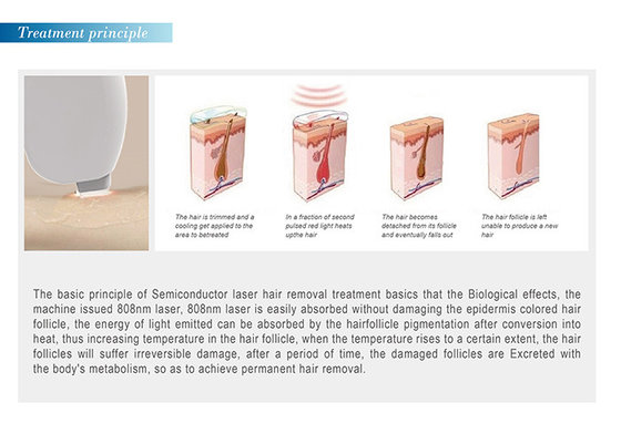 Pain Free 808nm Diode Laser Hair Removal Machine For Body Depilation