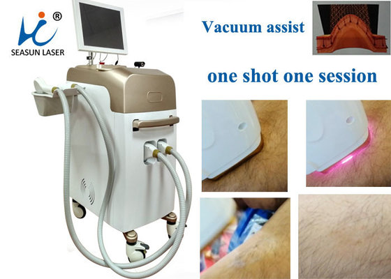 Fast Vacuum Laser Hair Removal Machine Comfortable Permanent Hair Reduction