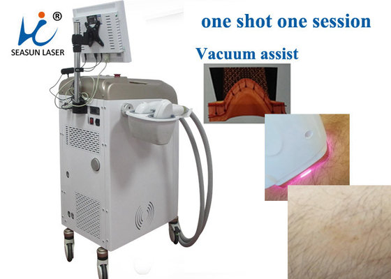 High Speed Vacuum Assisted Diode Laser Treatment For Hair Removal , Small Size