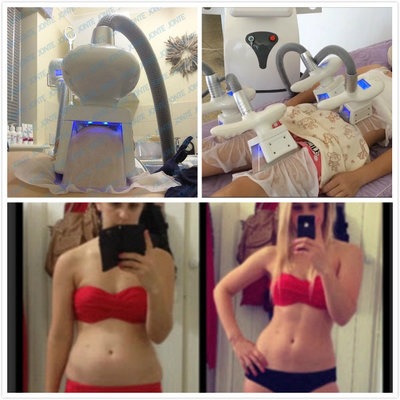 Vacuum Cryolipolysis Fat Freeze Body Shaping Machine With 4 Handpieces