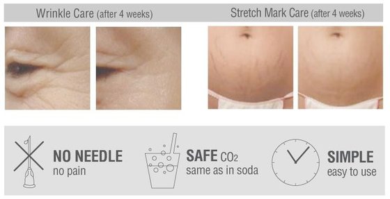 Clinicl CO2 Injection Carboxitherapy Machine For Cellulite Reduction