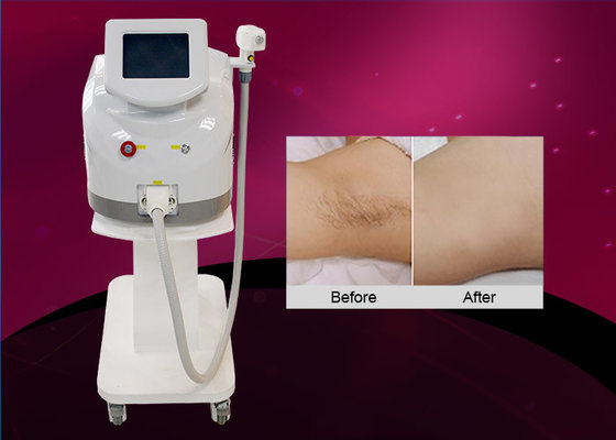 Powerful Laser Treatment Diode Laser Hair Removal Machine With Sapphire Crystal