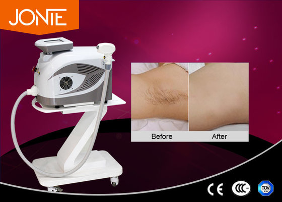 Pain-Free Diode Laser Hair Removal Machine , Alma SopranoSHR 810nm Laser Hair Removal