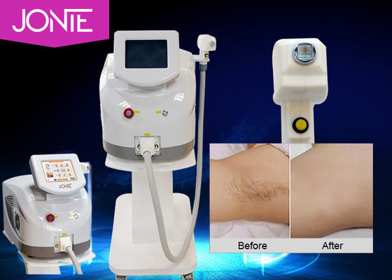 755nm diode laser hair remvoal machine for white skin and light hair