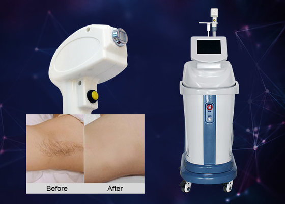 808nm diode laser hair removal machine for dark skin and light hair